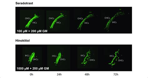 Montages Illustrating Representative Micro Explants Treated With 100