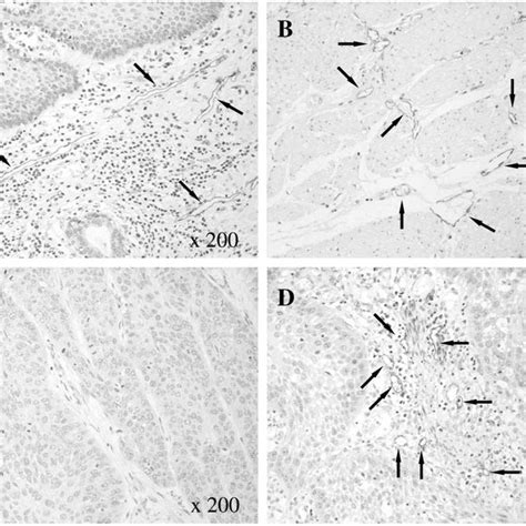 Podoplanin Positive Lymphatic Vessels A B Arrow At The Submucosal
