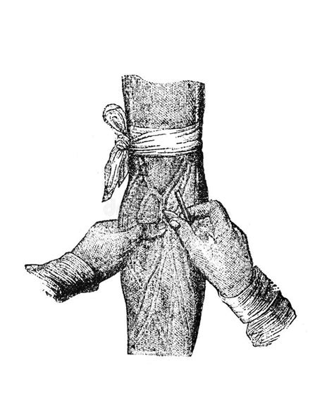 Bleeding From The Arm In The Old Book Encyklopedya Medycyny By