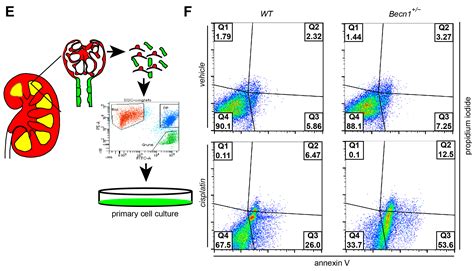 Ijms Free Full Text Cisplatin Nephrotoxicity Is Critically Mediated
