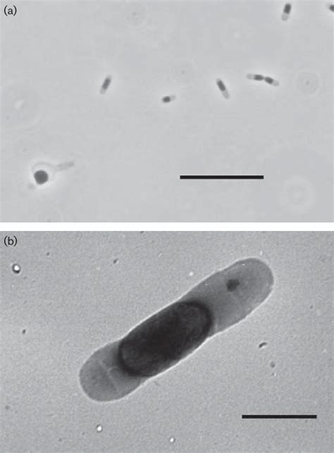 Phase Contrast Micrograph A And Transmission Electron Micrograph B