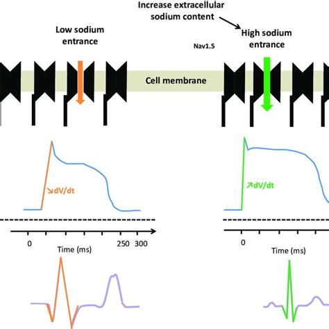 Pdf Sodium Is The Secret Re Agent Of Bicarbonate Therapy During Hyperkalemia