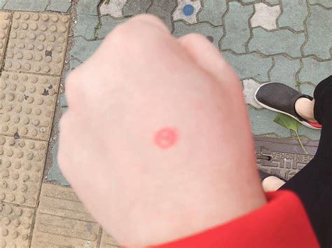 감스트 투표 인증 인스티즈 Instiz 이슈 카테고리