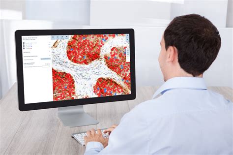 Clinical Ai Model For Lung Cancer Pd L1 Sectra Amplifier Marketplace