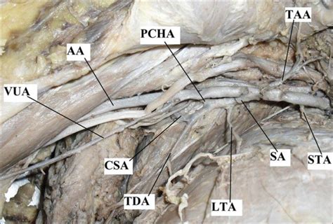 Thoracoacromial Artery Cadaver