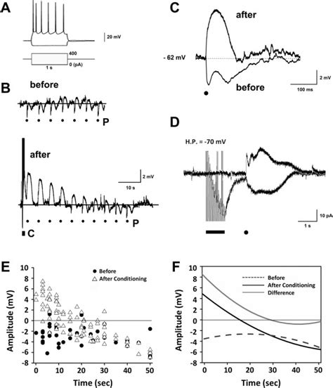 Gabas Effect On Exemplary Upper Layer Pyramidal Neuron Prior To And Download Scientific