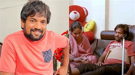 Punch Prasad పంచ్ ప్రసాద్‏కు అండగా ఏపీ ప్రభుత్వం జగన్ దృష్టికి