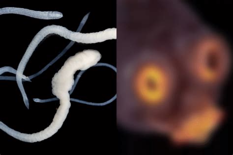 People Horrified After Discovering What A Tapeworm Looks Like Under A Microscope