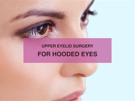 Hooded Eyes Surgery