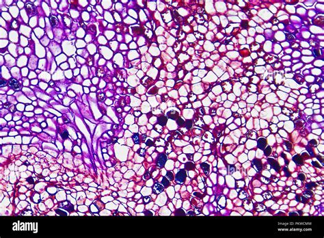 Micro Photo Of Crown Gall Plant Disease Caused By The Bacterium