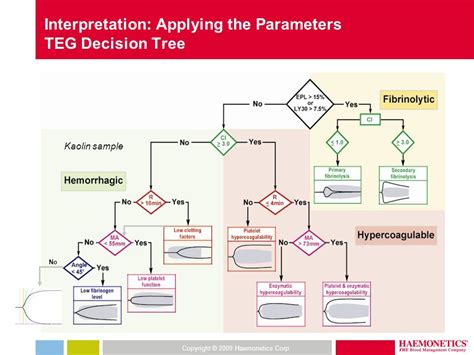 Teg® Interpretation Review Tracing Bootcamp Ppt Video Online Download