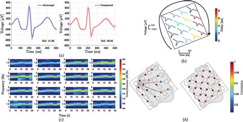 A Time‐independent Ensemble Average Of Ecg Peaks Generated From 30 S