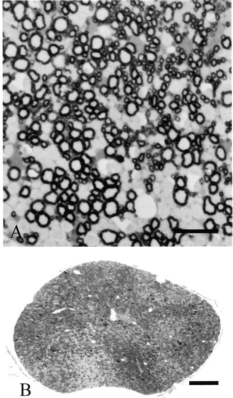 Heterozygote 4 Mo Old Mouse Cns Expressing Wild Type And Null Alleles