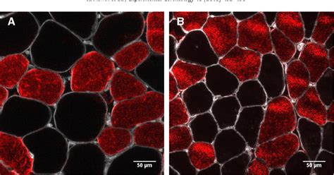 Figure 1 From The Decline In Skeletal Muscle Mass With Aging Is Mainly