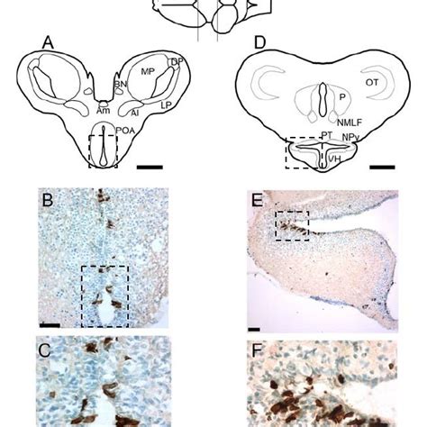 1 Schematics Of Brain Sections Showing The Distribution Of BrdU