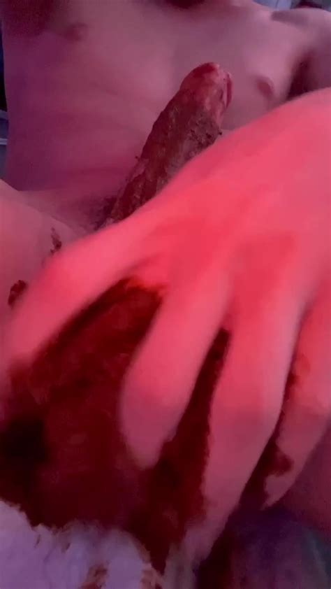 Accident Fun Thisvid Com