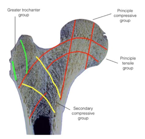 15 Hip Pathologies Flashcards Quizlet