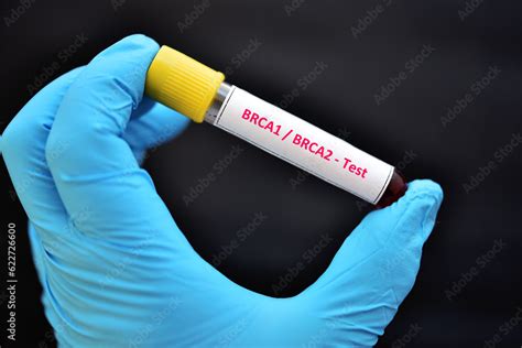 Blood Sample For Brca1 And Brca2 Test Gene Marker For Breast Cancer