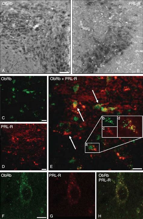 Leptin Obrb And Prolactin Prl R Receptor Localization In Female Rat