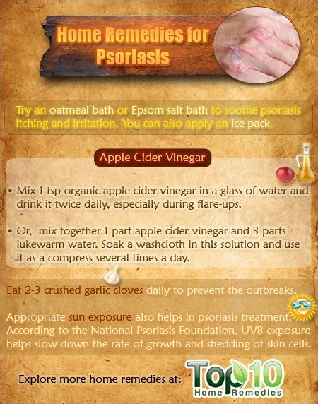 Home Remedies For Psoriasis Top 10 Home Remedies