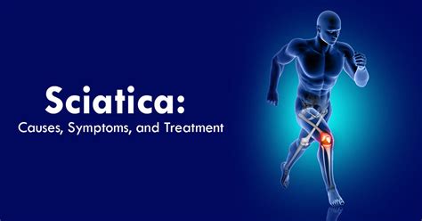 Sciatica Causes Symptoms And Treatment Realignspine Medium
