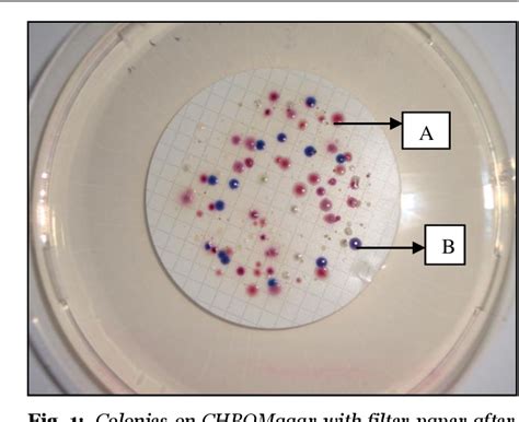What Is Membrane Filtration Technique In Microbiology At Andrea