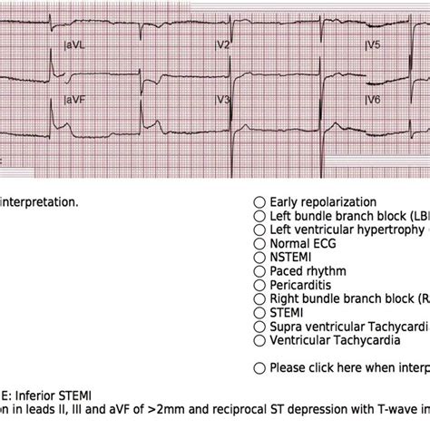 Accuracy Of Ecg Interpretation Represented As Mean Accuracy Download Scientific Diagram