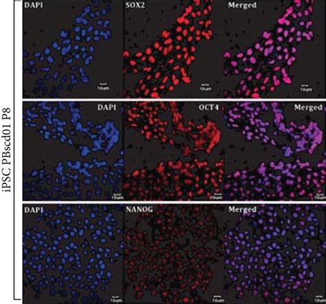 Characterization Of Ipsc Pbscd01 And Confirmation Of Pluripotency A
