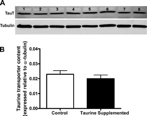Effect Of 2 Wk Taurine Tau Supplementation On Muscle Tau Transporter