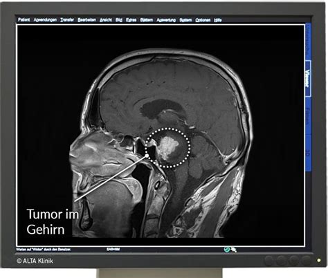 MRT Untersuchungen In Der Radiologie ALTA Klinik