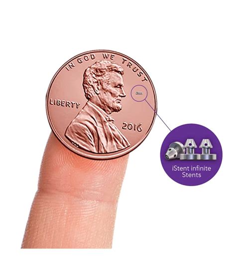 Glaukos Istent Infinite Migs System Approved In Australia Insight