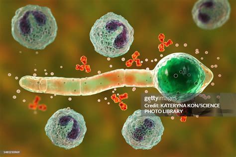 Splendorehoeppli Phenomenon Illustration High Res Vector Graphic