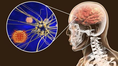 Coma Causes Symptoms And Long Term Outlook 1MD Nutrition