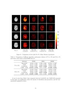 Two Stage Mr Image Segmentation Method For Brain Tumors Based On