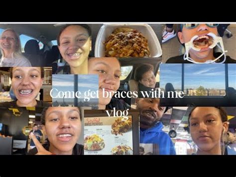 Getting Braces Vlog YouTube