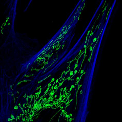 Sim Hms Super Resolution Microscopy In The Department Of Cell