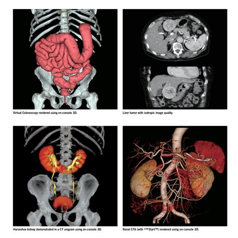 computed tomography 128 slices multi slice ct ‣ medical technologies