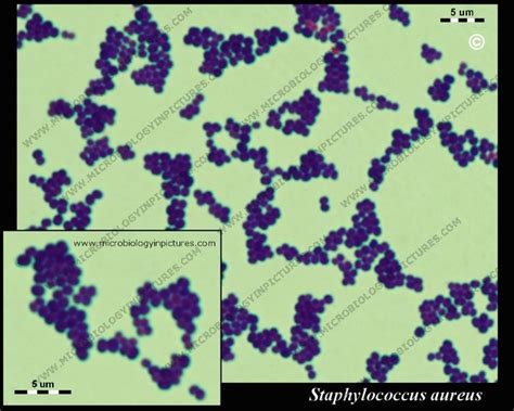 Gram Staining Staphylococcus Aureus Under Microscopes Vrogue Co