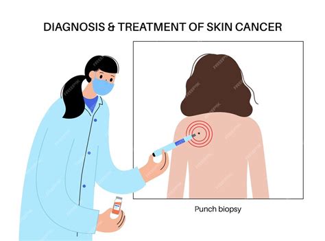 Premium Vector Punch Biopsy Procedure
