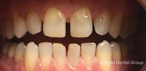 Gallatin Dental Group Dentist In Downey