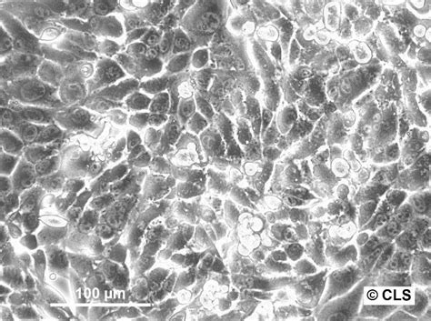 Renca Cells