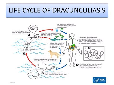 Dracunculiasis Ginea Worm Pptx