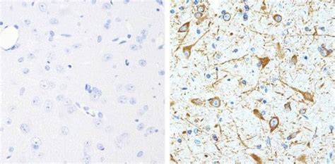 Phospho Tau Thr231 Recombinant Rabbit Monoclonal Antibody 1h6l6