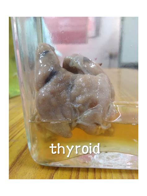 Surgery Specimen Pdf