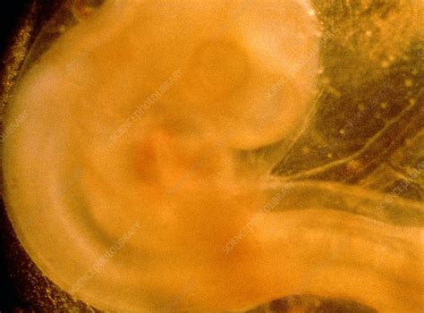 Fetal Development At 4 Weeks