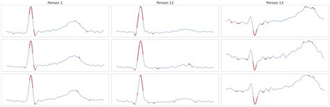 Saliency Maps For Randomly Selected 3 Different Persons From The Ecg Id