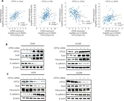 Carnitine Palmitoyltransferase 1C Promotes EMT Associated Cisplatin