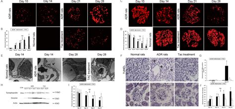 Tacrolimus Promoted Podocyte Repair In Adr Rats A Immunofluorescence