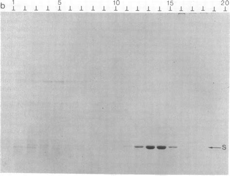 Fractionation Of Pea Chloroplast Soluble Proteins By Sucrose Density