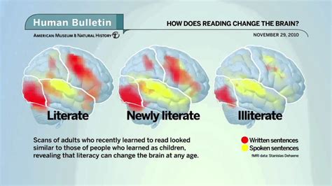 How learning to read rewrites the brain 閱讀重塑腦部結構的秘密 PowerBrain RX